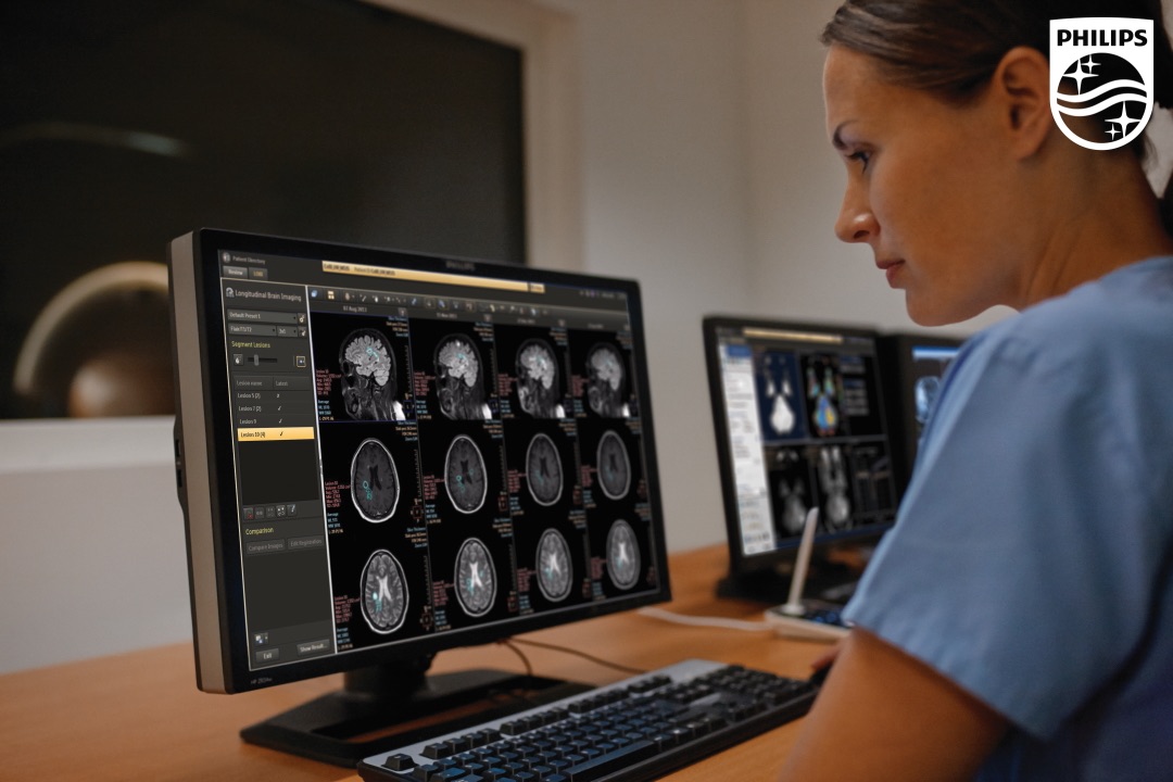 IntelliSpace Portal Philips.Cardio-Vascular.2ª Edició